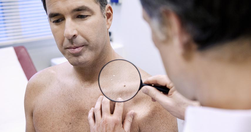 What Does Skin Cancer Feel Like? Does It Hurt? – Tiege Hanley