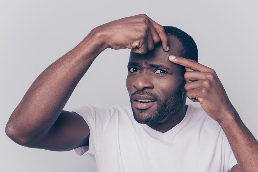 Forehead Bumps: What They Are & How to Treat Them – Tiege Hanley